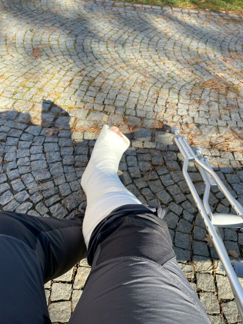 Pracovní úraz rozdrcení nohy | Právo zaměstnance